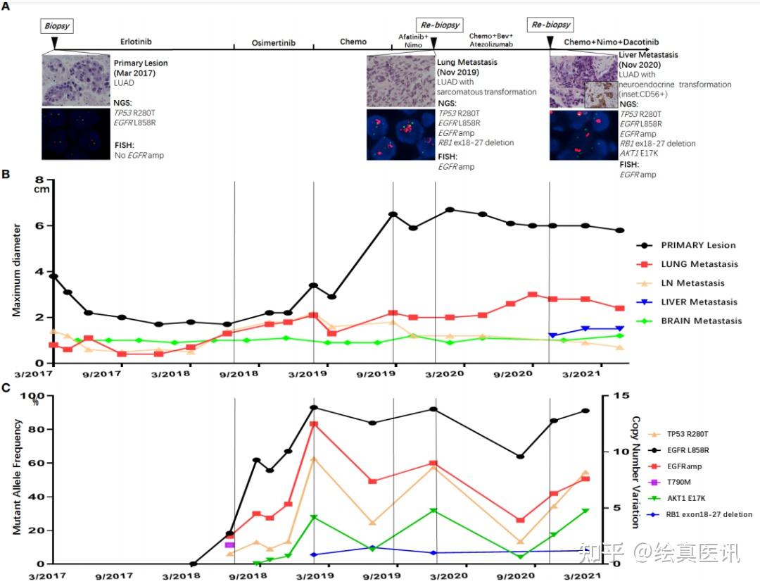 EGFR突变非小细胞肺癌患者在不同情形下检出EGFR扩增，有何临床意义？ - 知乎