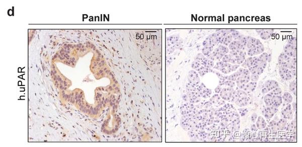 Nature丨“返老还童”新突破：uPAR助力CAR-T提高抗衰老效果 - 知乎