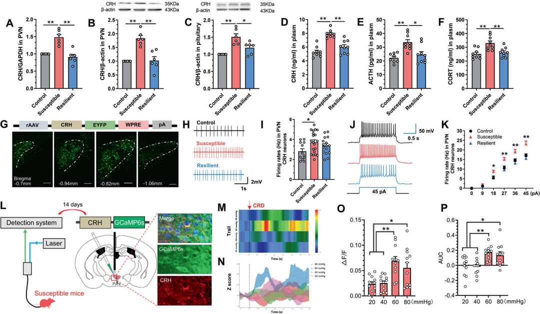 【客户文章】徐州医科大学张咏梅教授团队揭示avBNST-PVN神经环路介导生命早期应激致成年慢性内脏痛易感性的机制 - 知乎