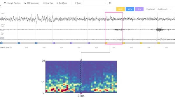 【Lunion Stage】如何使用频谱图提高睡眠分析效率 - 知乎