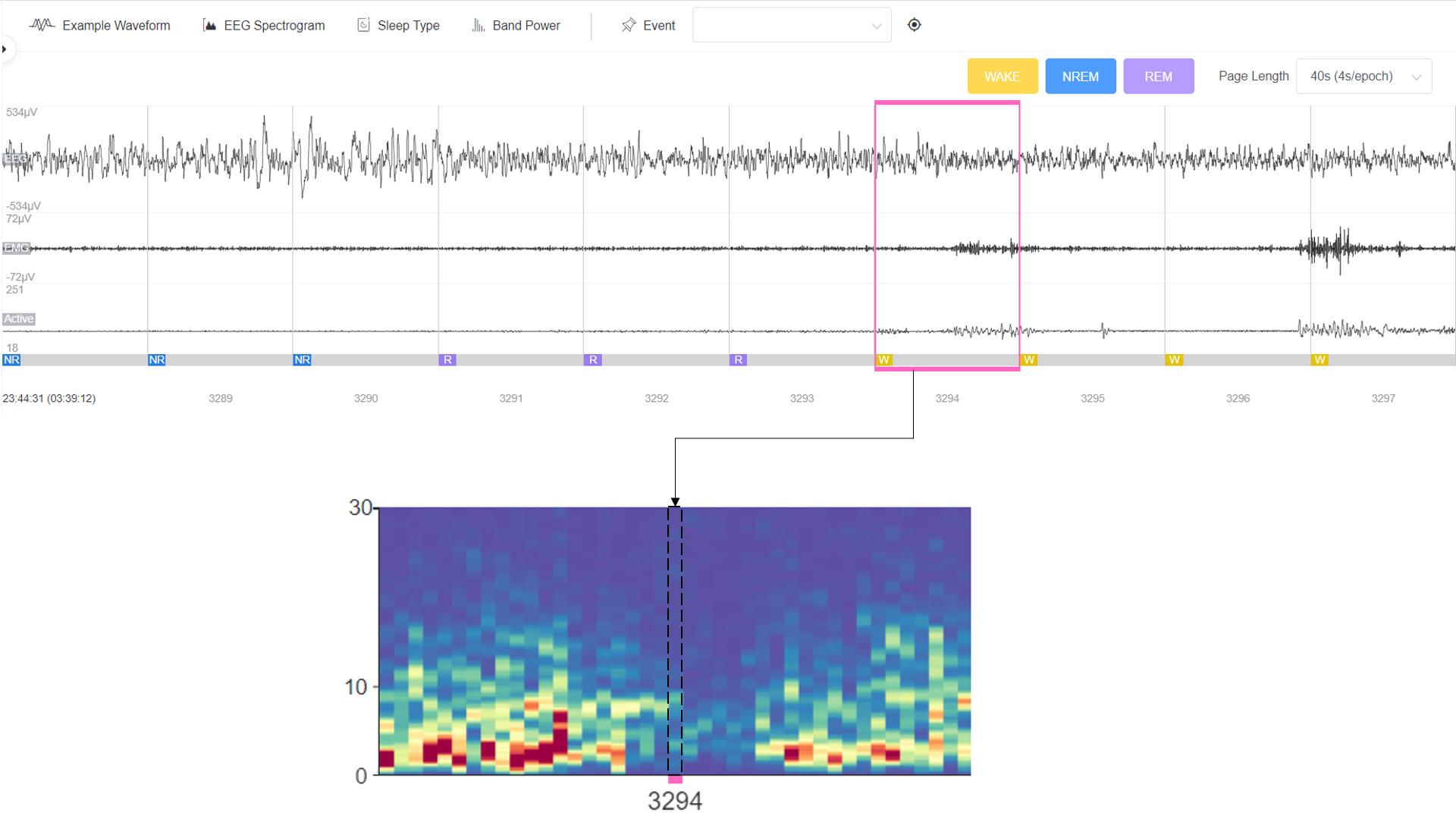 【Lunion Stage】如何使用频谱图提高睡眠分析效率 - 知乎