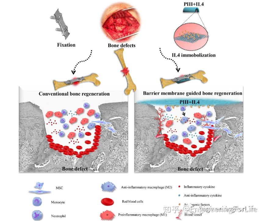 《ACS AMI》：离子屏障膜免疫调节定向引导骨再生 - 知乎