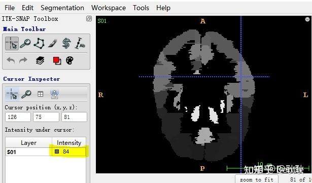 [论文笔记] VoxelMorph - 知乎