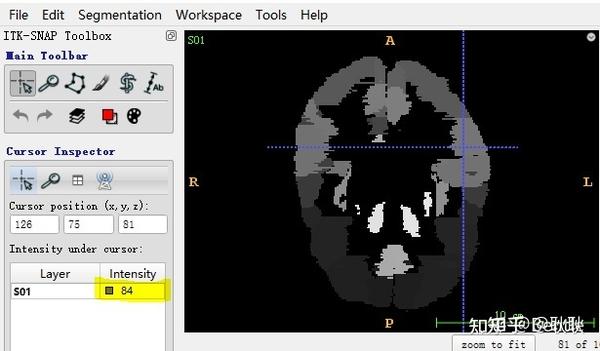 [论文笔记] VoxelMorph - 知乎