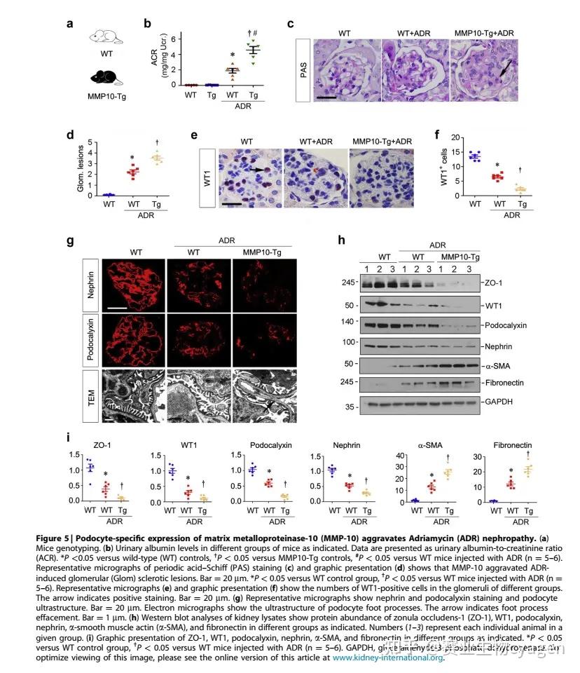 MMP10-新的足细胞损伤介导分子 - 知乎