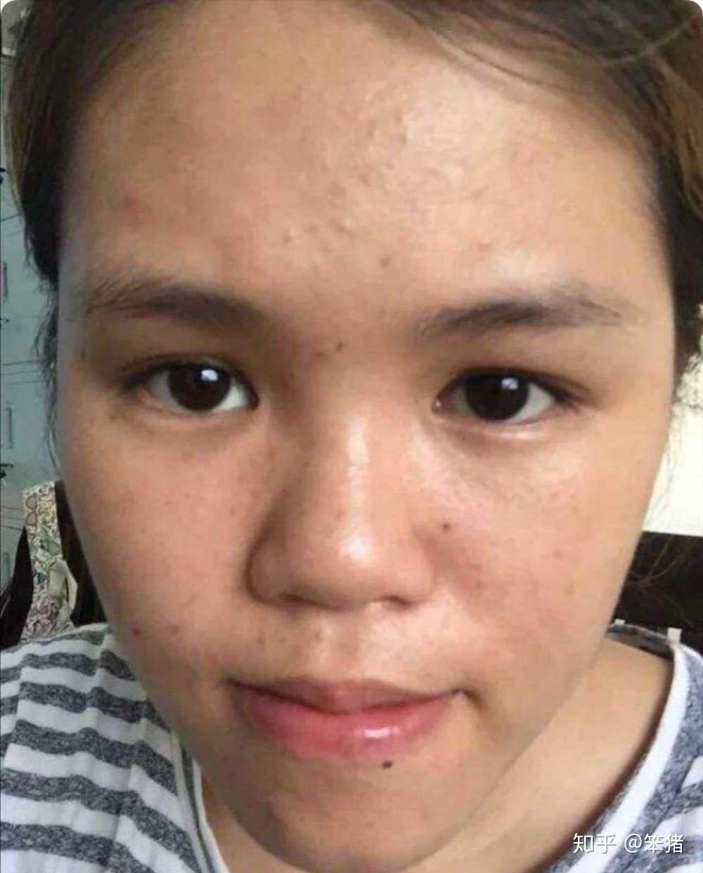 良心分享美白心得,最后一个月美白成功~ 知乎
