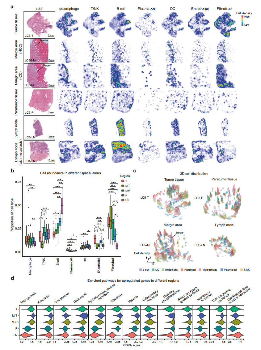 Cell Res | Stereo-seq揭示人类肝癌浸润区促进肝细胞-肿瘤细胞串扰、局部免疫抑制和肿瘤进展 - 知乎