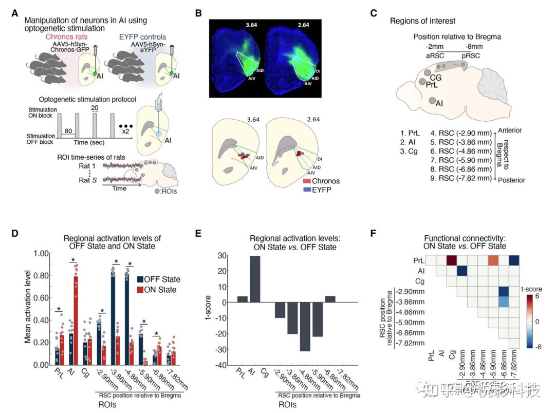 Neuron重磅综述|默认模式网络20年：回顾与综述 - 知乎