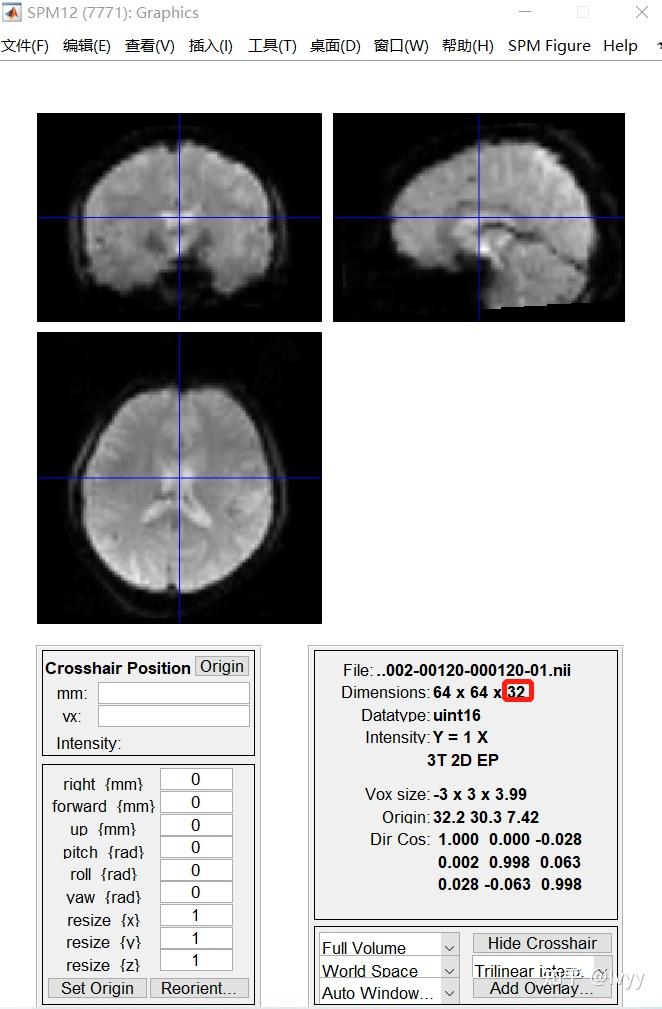 SPM数据预处理 -单被试 - 知乎