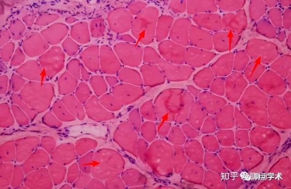 首创！IPP（Image-Pro Plus）精准测量肌纤维直径的方法讲解 - 知乎