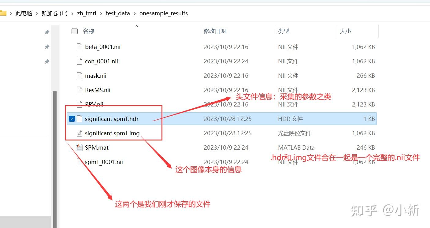 15（1）-SPM-fmri任务态 结果查看与汇报 xjview - 知乎