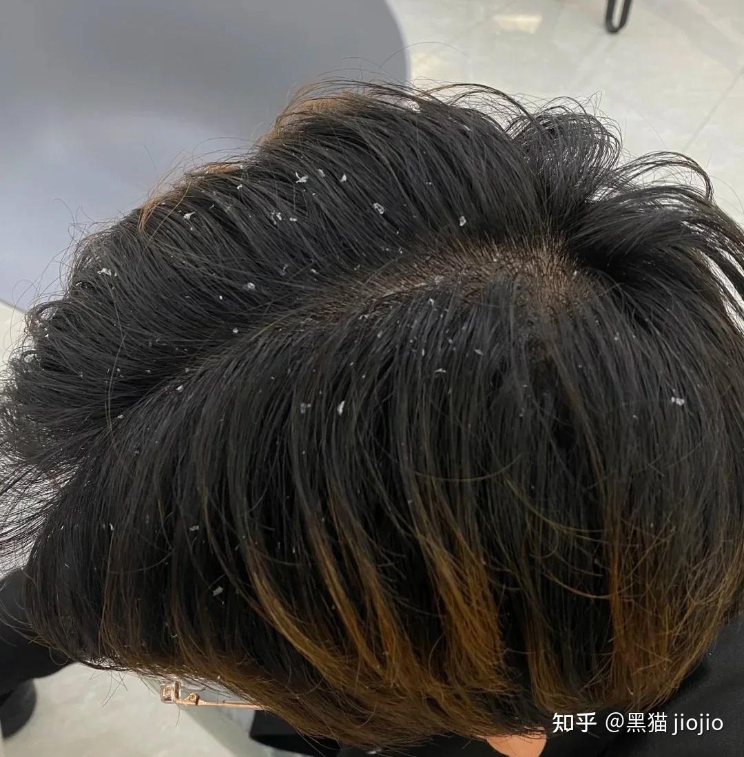 有人用过哈恩咖啡因洗发水吗？控油去屑真那么神奇吗？ - 知乎