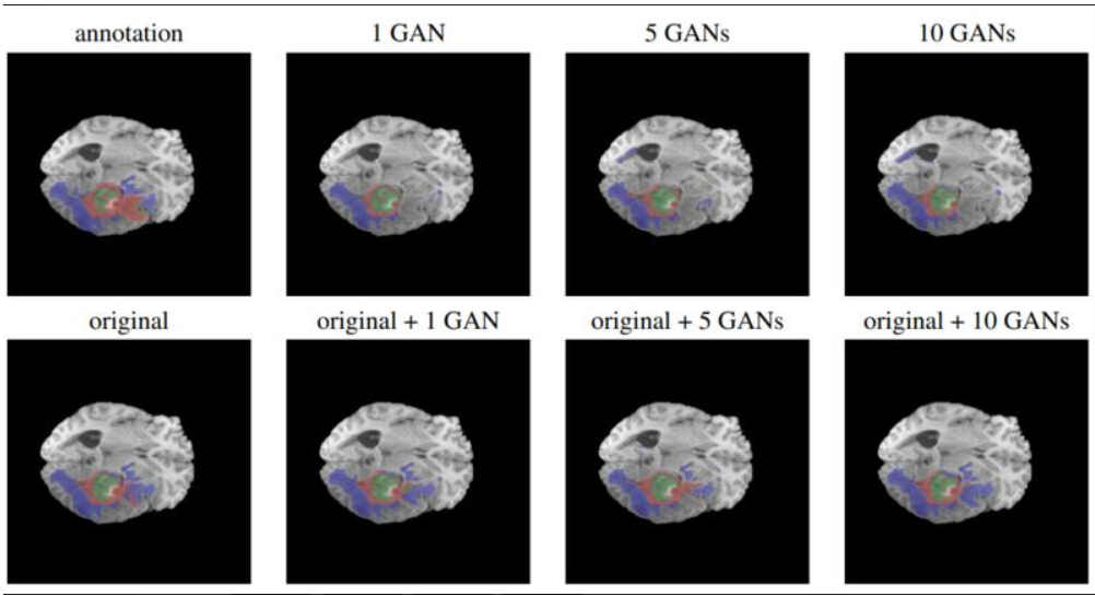 论文汇总简析：生成对抗GAN和扩散模型来扩充训练数据 - 知乎