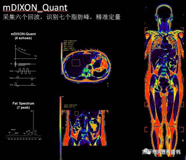磁共振序列的命名及名称（不同厂家之间的序列名）（三） - 知乎