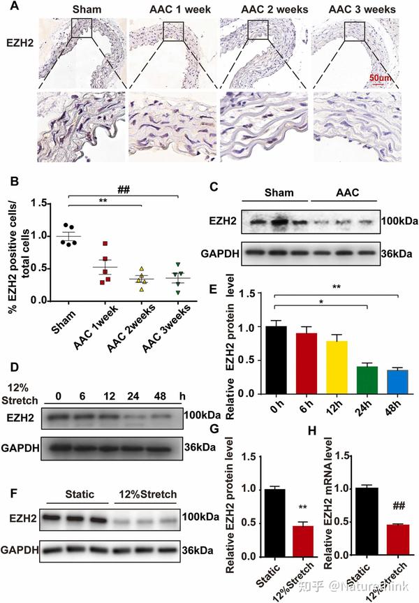 机械拉伸通过下调EZH2加重血管平滑肌细胞凋亡和血管重塑 - 知乎