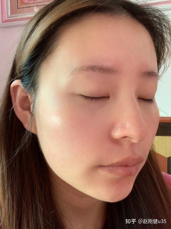 怎么判断自己是不是敏感肌? 知乎