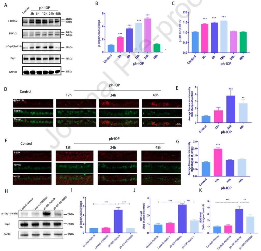 Redox Biology丨氧化应激顶刊丨病理性高眼压通过 Drp1 诱导线粒体功能障碍并导致PANoptosis - 知乎
