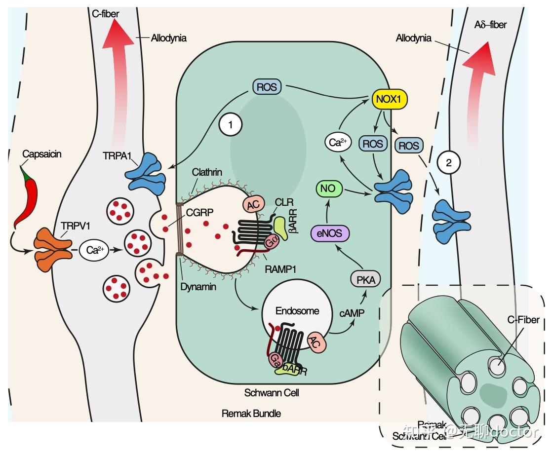回顾2022——头痛领域的年度重点研究进展 - 知乎
