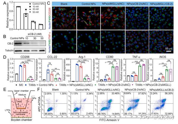 还原响应型RNAi纳米平台重组肿瘤脂质代谢和复极化巨噬细胞用于胰腺癌联合治疗 - 知乎