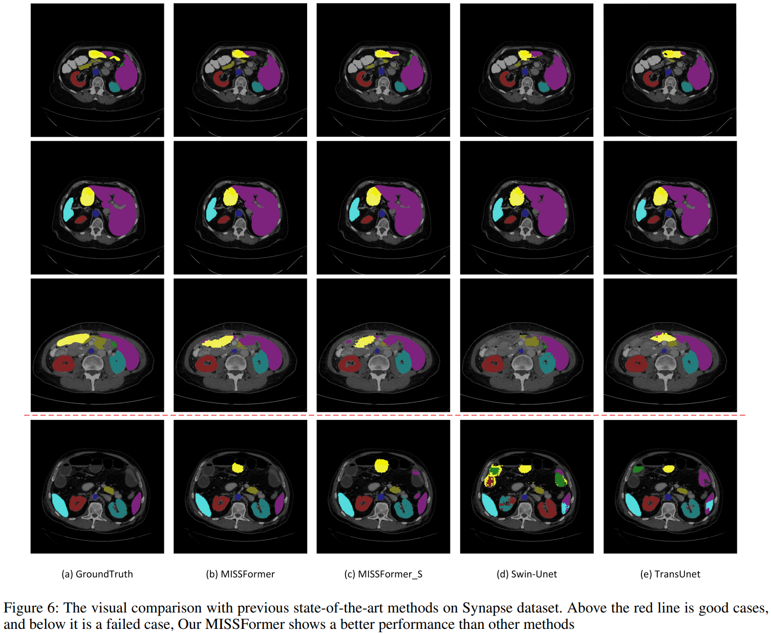 【TMI 2023】MISSFormer：一种用于2D医学图像分割的高效Transformer（MISSFormer） - 知乎