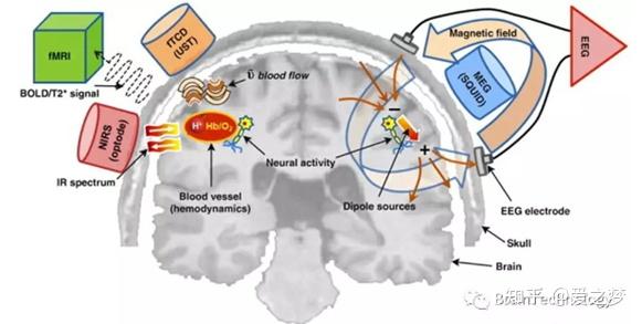 EEG VS MRI VS fMRI VS fNIRS基本简介 - 知乎