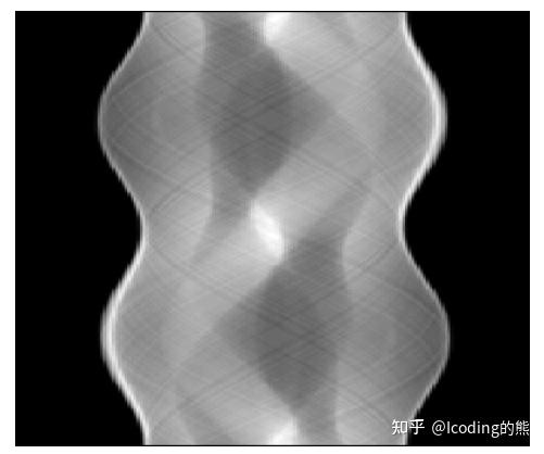 Radon变化的matlab实现 - 知乎