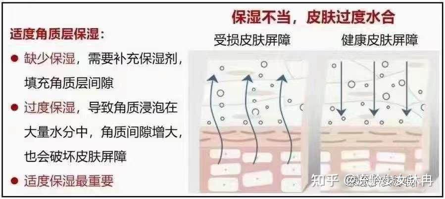 天天敷面膜，小心皮肤屏障被破坏 知乎