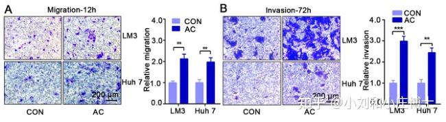SCI赏图录（C）transwell实验 - 知乎