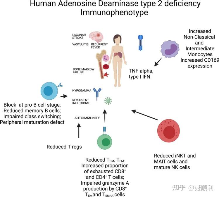 罕见病挑战（4）：DADA2的诊断与治疗 - 知乎