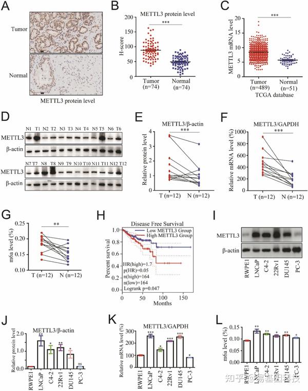 易基因：MeRIP-seq等揭示m6A RNA甲基转移酶METTL3抑制剂在体内和体外抑制前列腺癌进展 | 医学研究 - 深圳市易基因科技 - 博客园