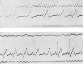 脑电系列第一期：初识脑电，EEG与ERP的关系 - 知乎