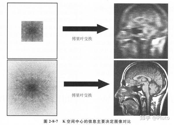sMRI磁共振成像的物理学原理 - 知乎