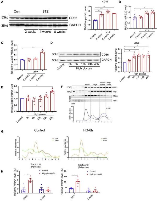 华中同济医院最新糖尿病心肌病(DCMP)模式动物实验发现MiR-320和CD36正反馈回路 - 知乎