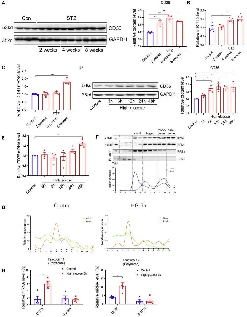华中同济医院最新糖尿病心肌病(DCMP)模式动物实验发现MiR-320和CD36正反馈回路 - 知乎