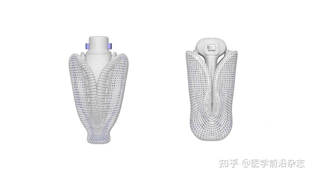 爱德华PASCAL Precision：获得FDA批准进行二尖瓣介入治疗 - 知乎