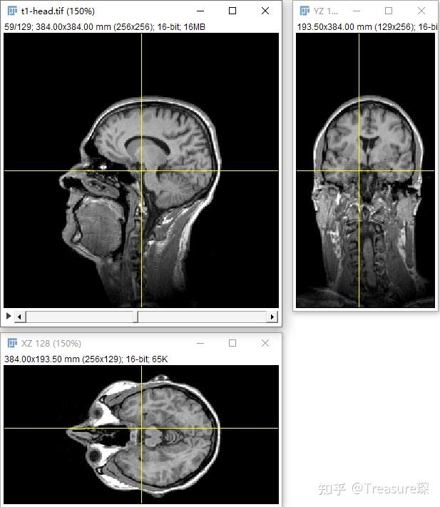 ImageJ实用教程——3D Stack Reslice(基本功能篇) - 知乎