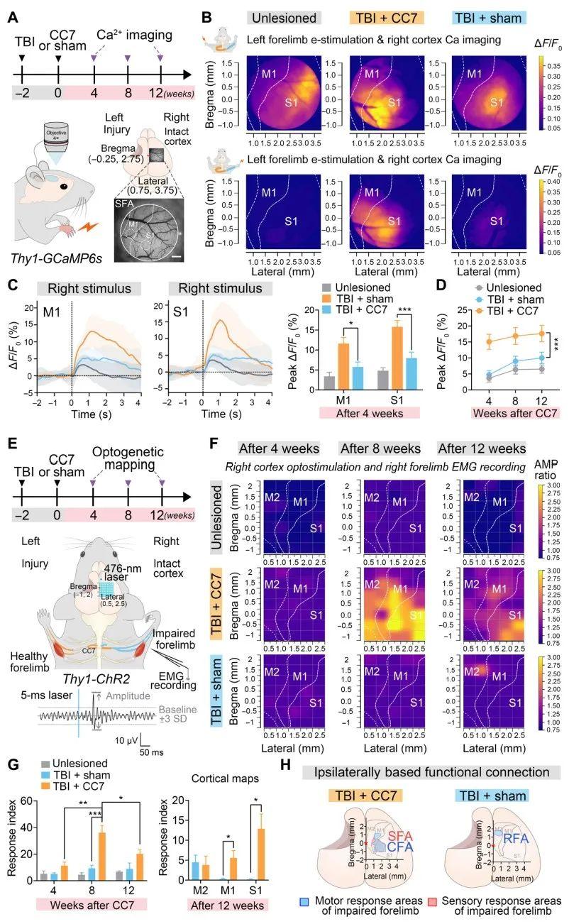 小布解读 | “一侧半球管双手”，CC7移位术为治疗脑损伤提供新策略！ - 知乎