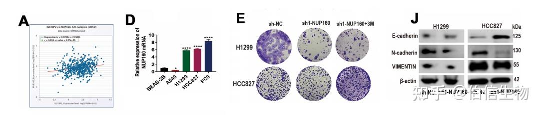 M6A甲基化circRAPGEF5通过IGF2BP2/NUP160介导的自噬抑制驱动肺腺癌进展与转移 - 知乎
