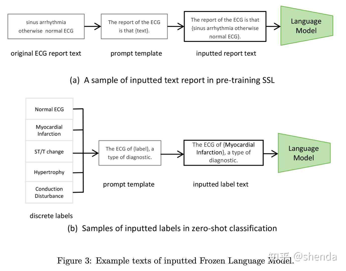 [MIDL 2023] 利用语言模型帮助心电信号零样本学习 - 知乎