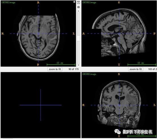 SynthRAD2023——放射治疗的CT合成 - 知乎