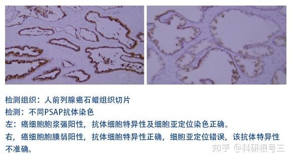 定性、定量、定位，WB、ELISA、IHC 三大免疫学实验，这一篇全搞定！ - 知乎