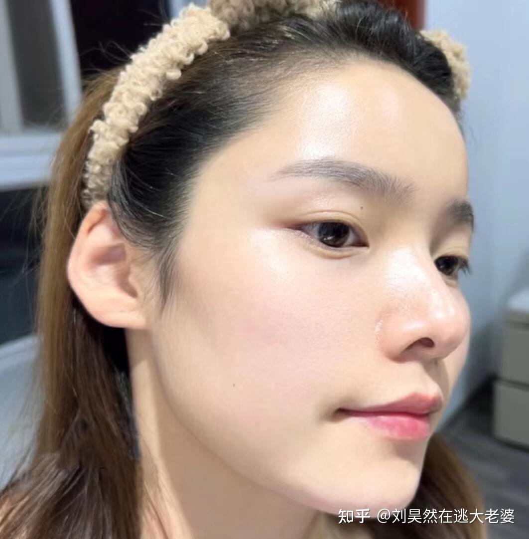 尝试几十种美白面膜!还得是皮肤科医生推荐的最绝,30天美白去黄、脸嫩到会发光!