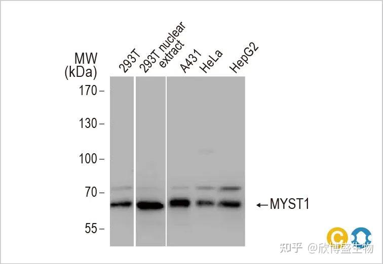 IFNγ刺激的KAT8-IRF1凝聚体可激活PD-L1表达并促进免疫逃逸 - 知乎