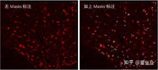 使用Cellpose和ImageJ分析多标细胞荧光强度 - 知乎