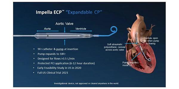 深度解读：人工心脏技术的历史发展及国内外技术现状 - 知乎