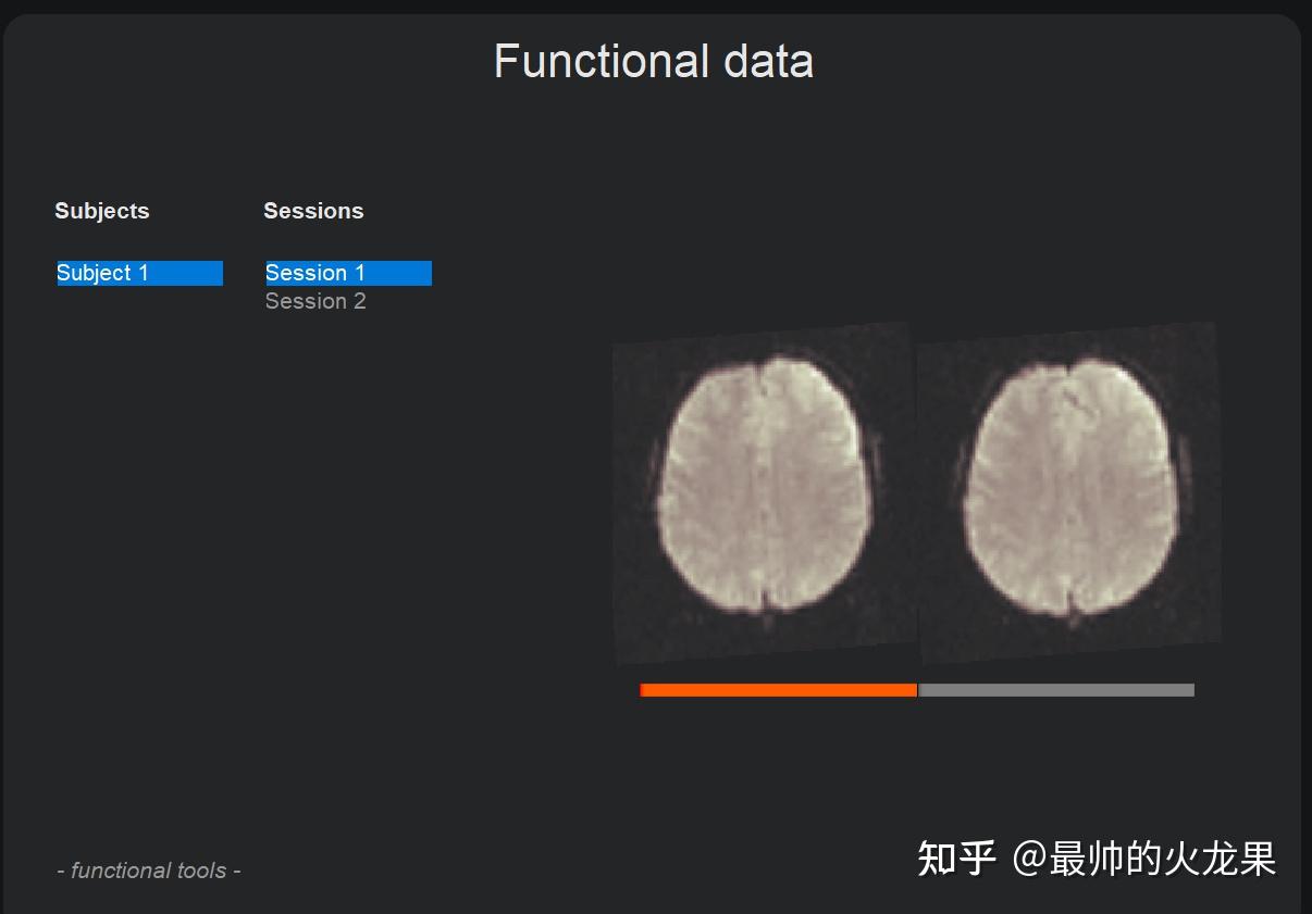 fmri 任务态学习笔记一：conn onset和duration的设置 - 知乎