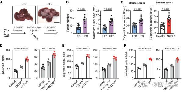 Cell Metab重磅！转移前微环境 — 全新视角解析转移性肿瘤 - 知乎