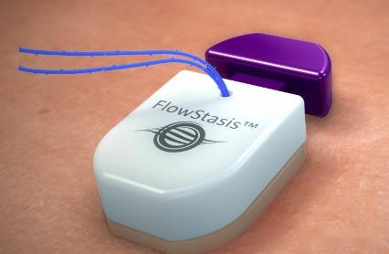 械企风云 | 血管介入治疗行家Inari Medical - 知乎