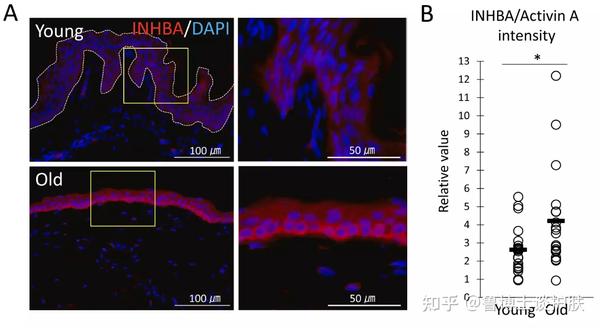 皮肤衰老机制的新发现——INHBA蛋白的积累引起角质层更新效率降低 - 知乎
