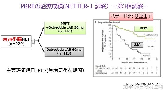 日本国立癌症研究中心专家介绍神经内分泌肿瘤的最先进疗法-PRRT - 知乎